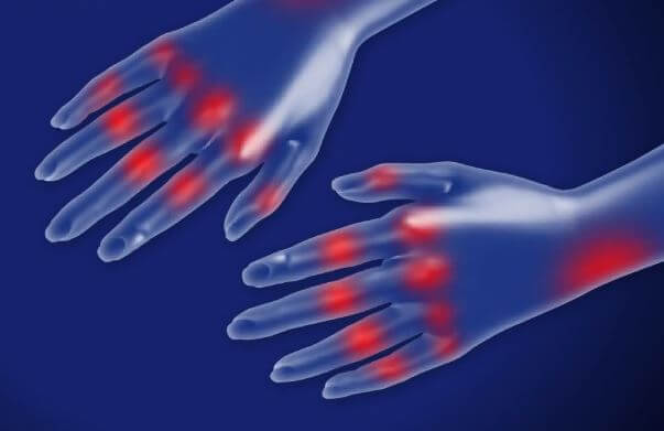 The Many Different Kinds of Arthritis | Twin Cities Pain Clinic