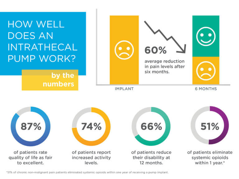 Intrathecal Pain Pump – A Review | Twin Cities Pain Clinic