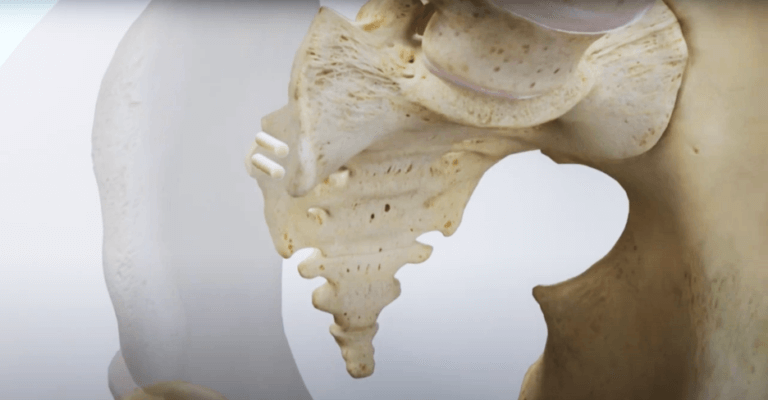 Understanding SI Joint Dysfunction & Minimally Invasive Fusion