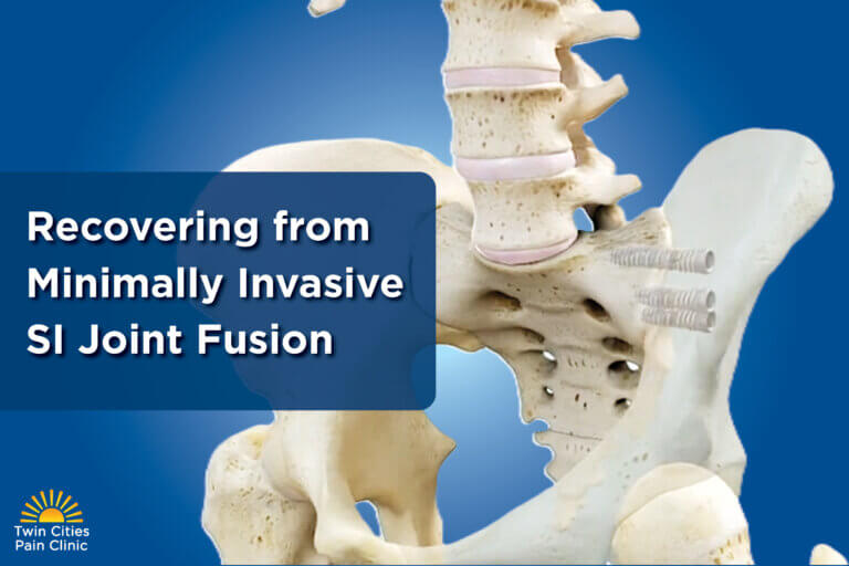 What Is the Recovery Time for Minimally Invasive SI Joint Fusion?